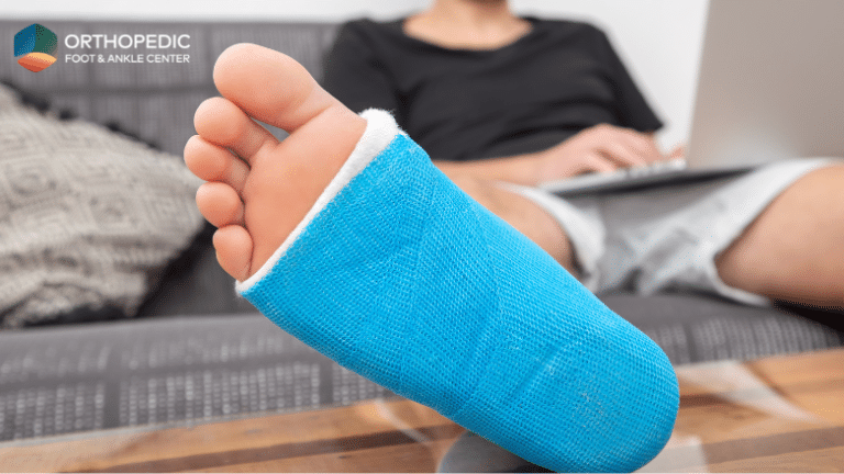 Casting and Bracing - Orthopedic Foot & Ankle Center