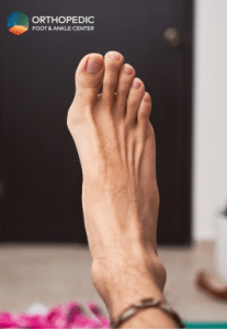 Foot Deformities - Orthopedic Foot & Ankle Center